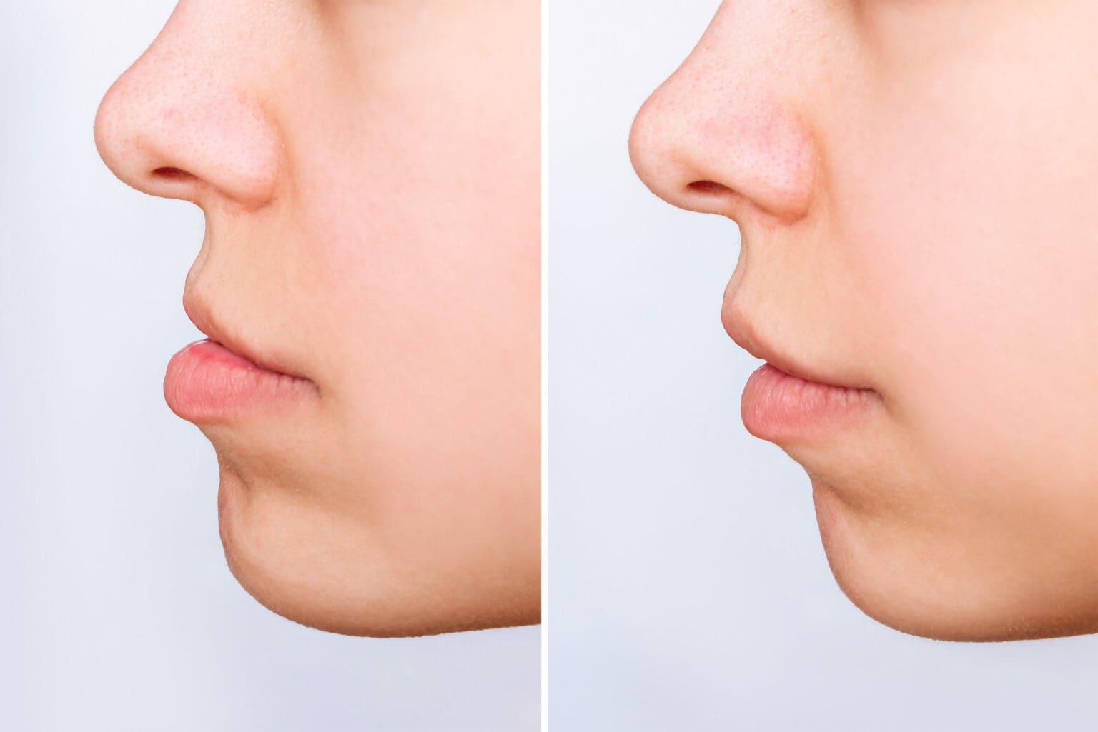 What You Should Know About Facial Reconstruction? | Adara Surgical ...