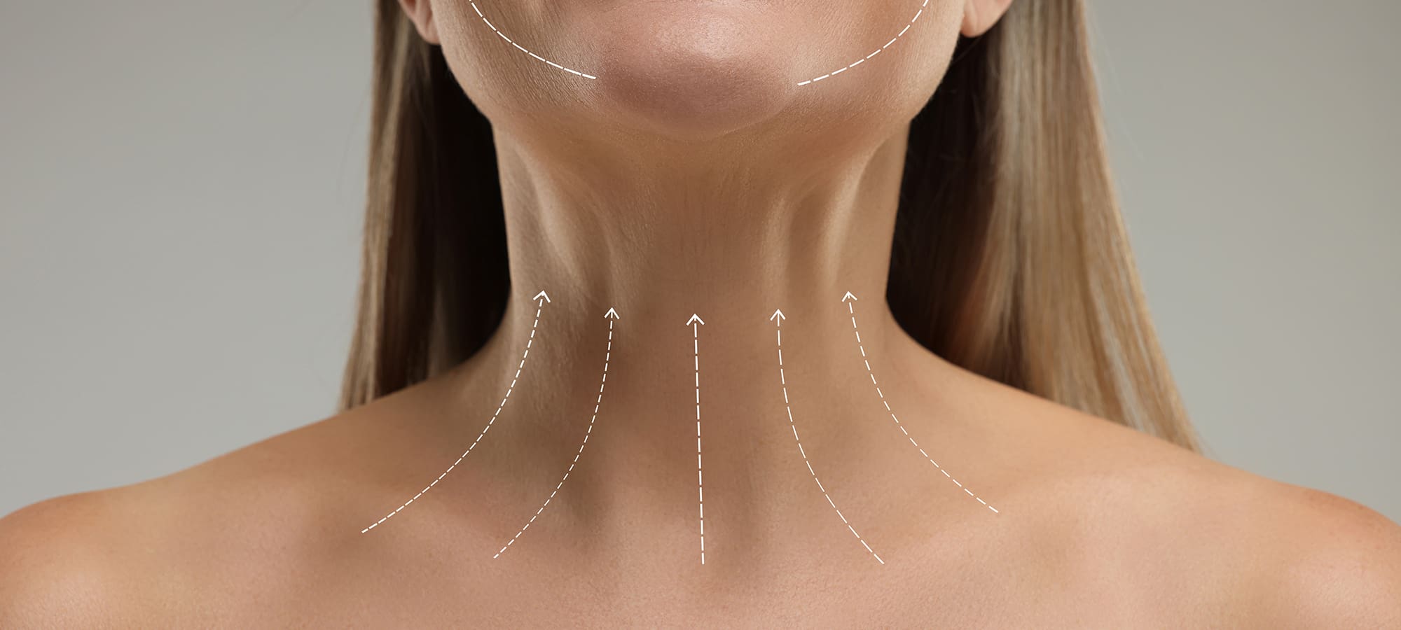 Neck Lift Surgery | Lower Rhytidectomy | Adara Surgical Institute ...