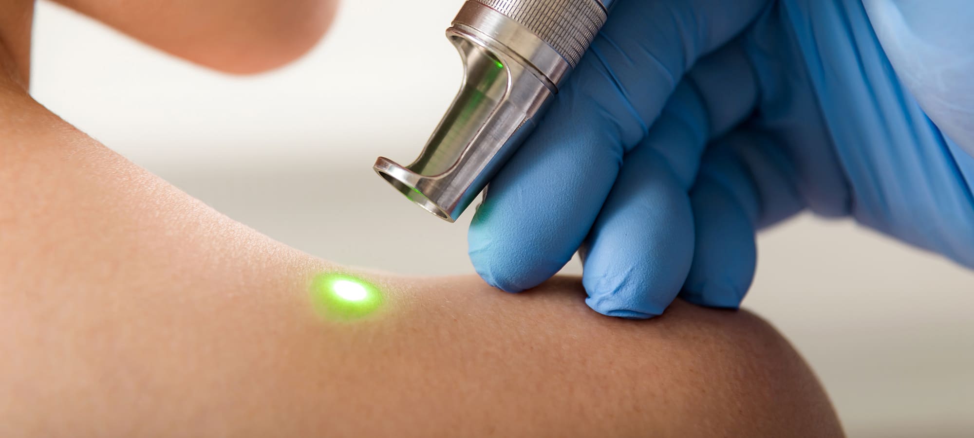 Skin Lesion Removal Issaquah WA | ASI Medical Spa | Adara Surgical ...
